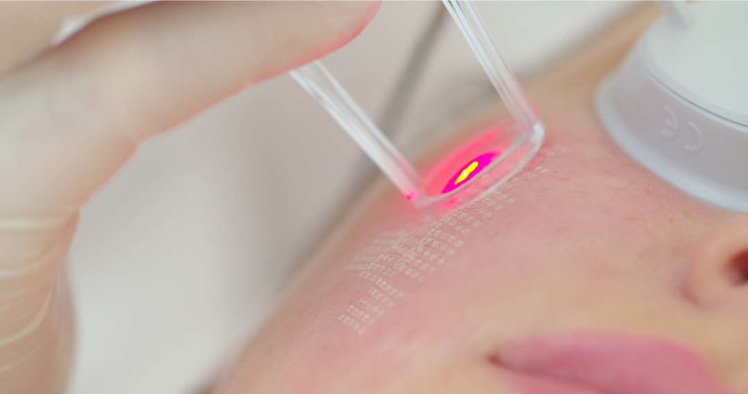 iPixel - Vixen Aesthetics